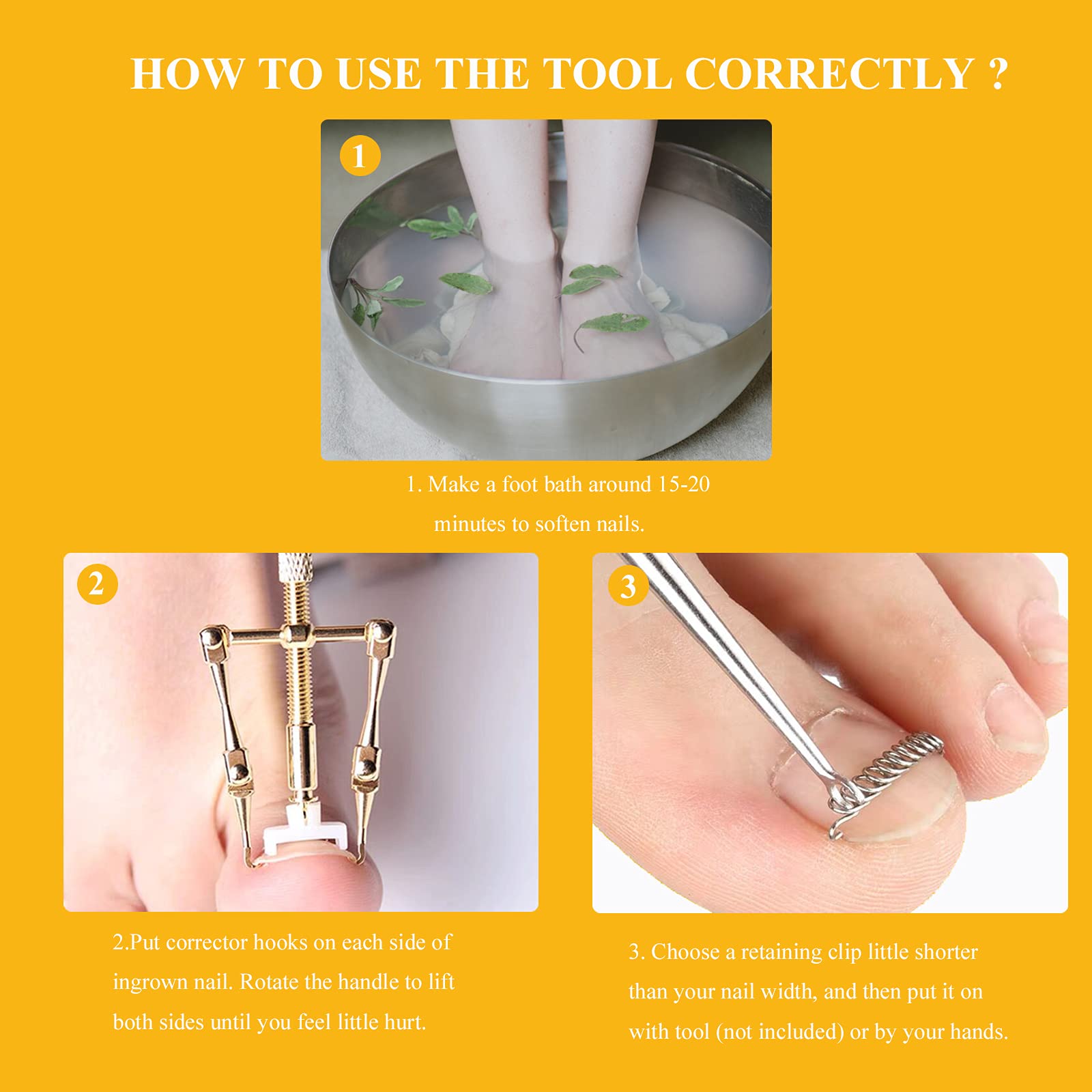 Buy Ingrown Toenail Treatment Kit, Ingrown Toenail Corrector Stainless ...