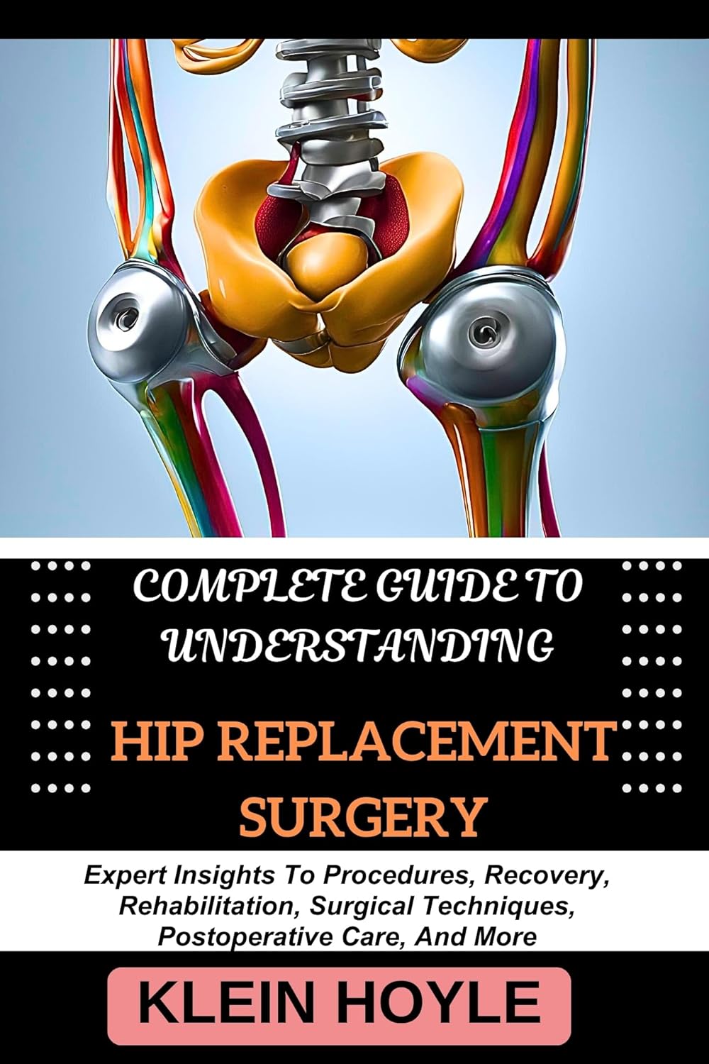 Amazon.com: COMPLETE GUIDE TO UNDERSTANDING HIP REPLACEMENT SURGERY ...