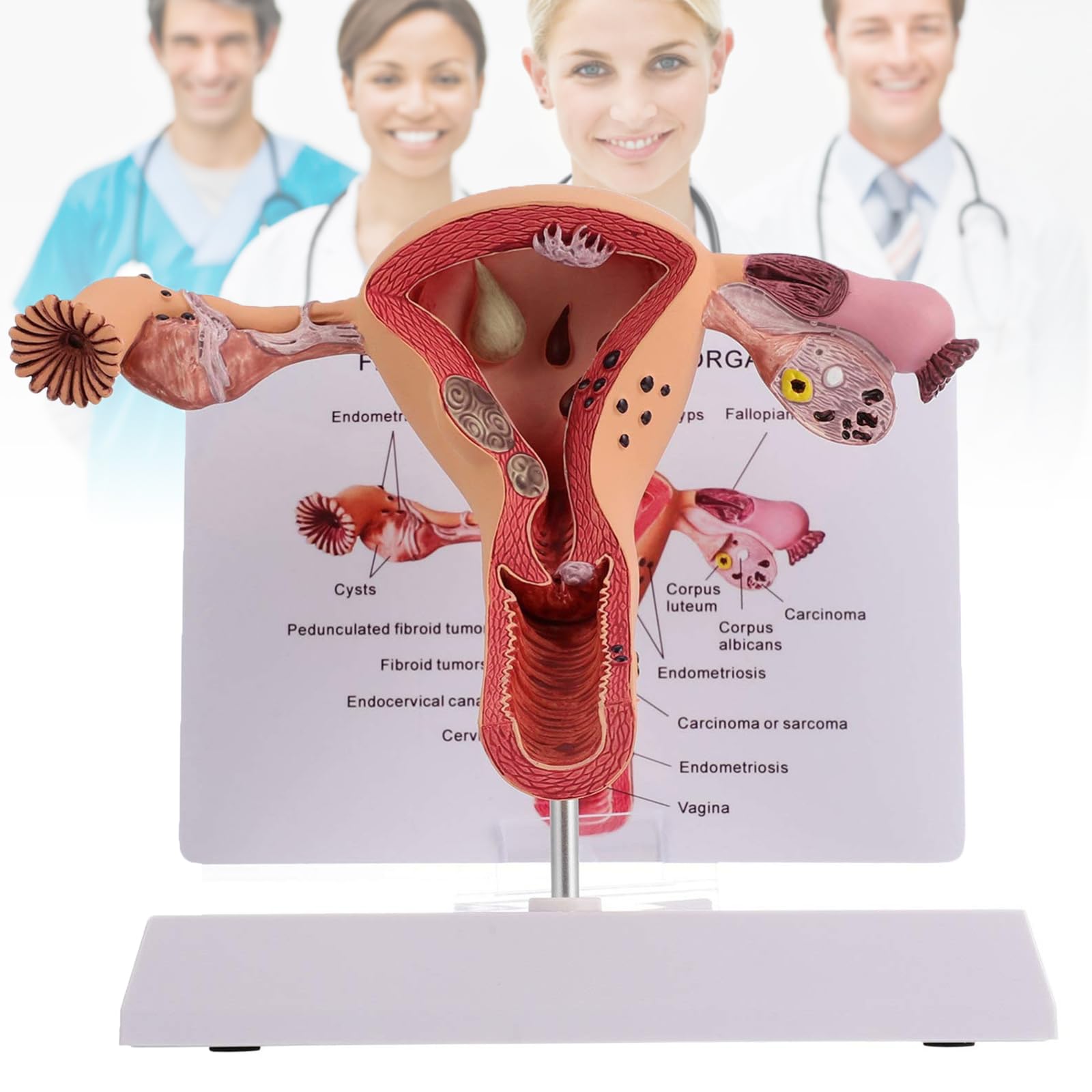 Sistemas Del Cuerpo Humano Femenino Estructura Anatómica Del Cuerpo
