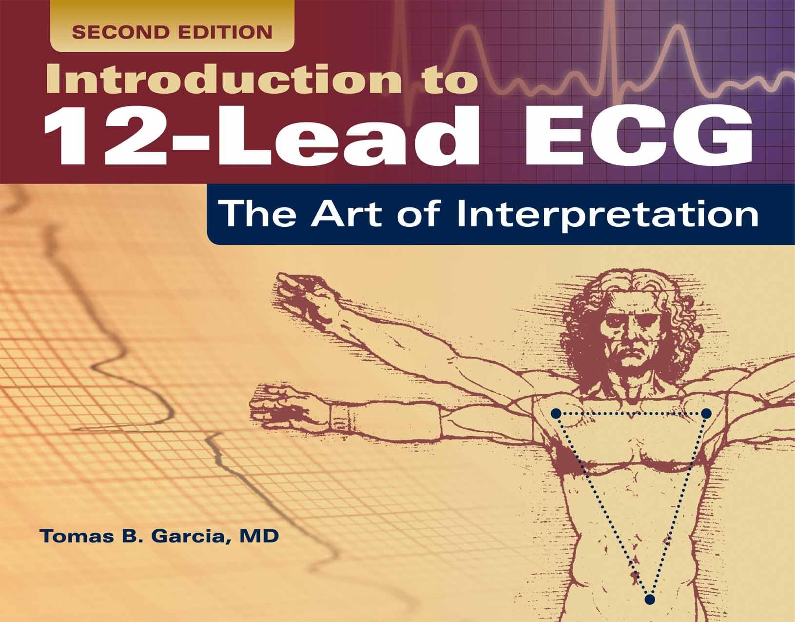 Introduction to 12-lead ECG: the Art of Interpretation: Amazon.co.uk ...