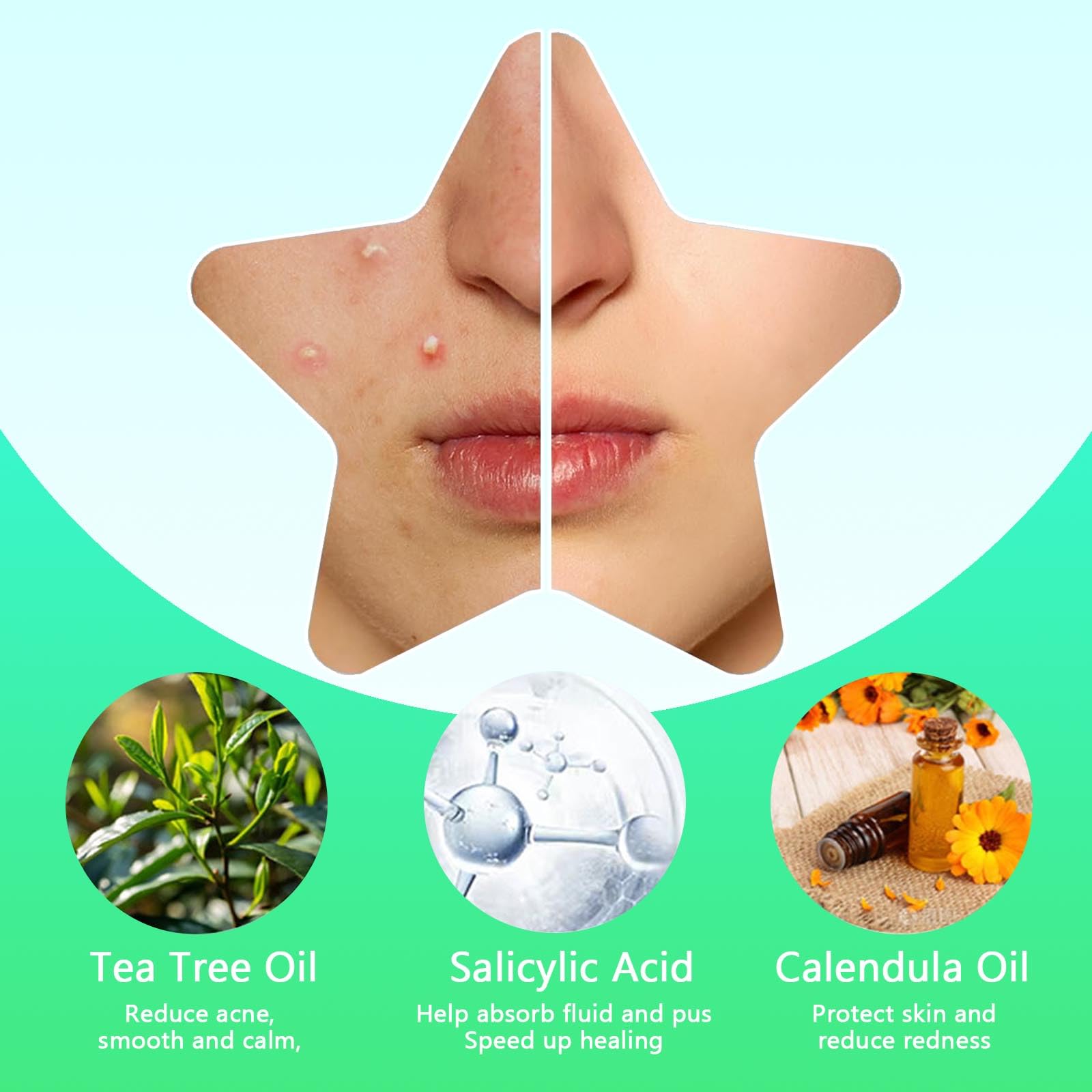 GWAWG Acne Pimple Patch,234 Dots Star Pimple Patches Stars Spots ...