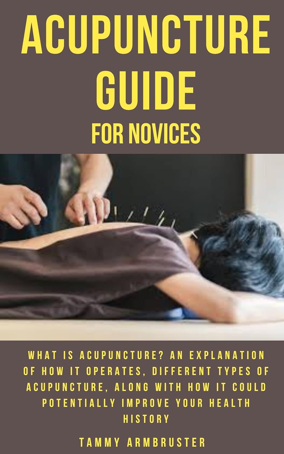 ACUPUNCTURE GUIDE FOR NOVICES: What Is Acupuncture? An Explanation Of ...