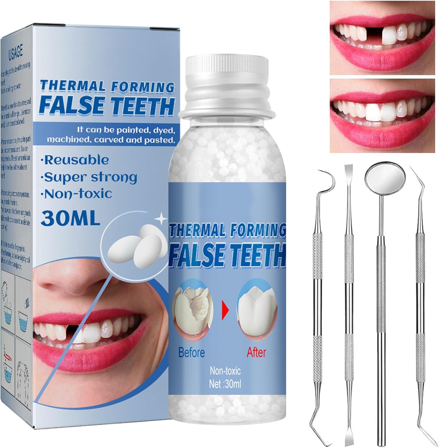 FEXPDL Tooth Filling Repair kit,Tooth Repair Kit with 4 Dental Tools ...