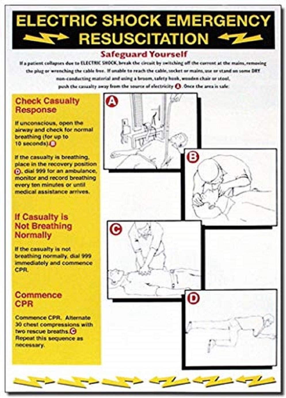 Electric Shock Poster 590 x 423mm : Amazon.co.uk: Health & Personal Care