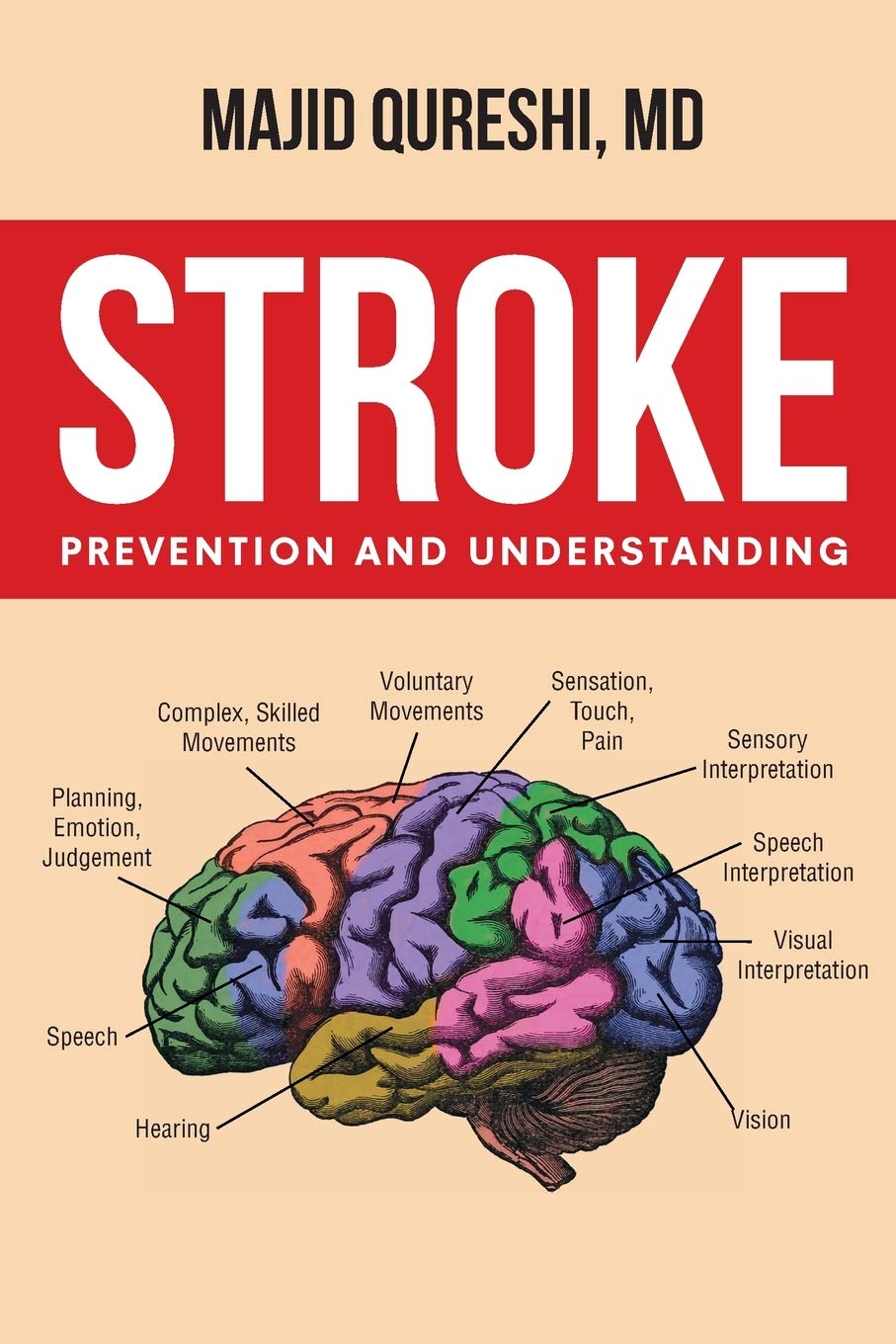 Amazon.com: Stroke: Prevention and Understanding: 9781662410253 ...