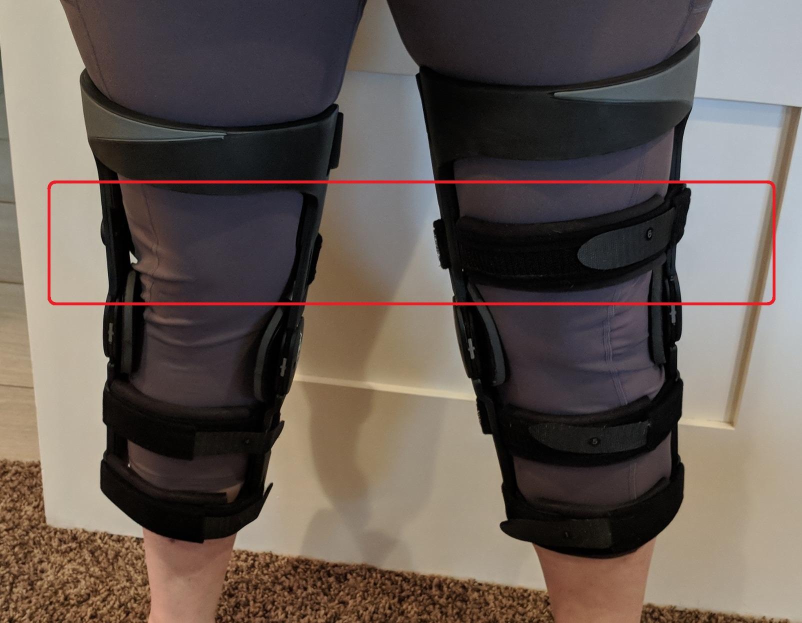 Amazon.com: DonJoy Legend SE-4 Knee Support Brace: CI (Combined ...