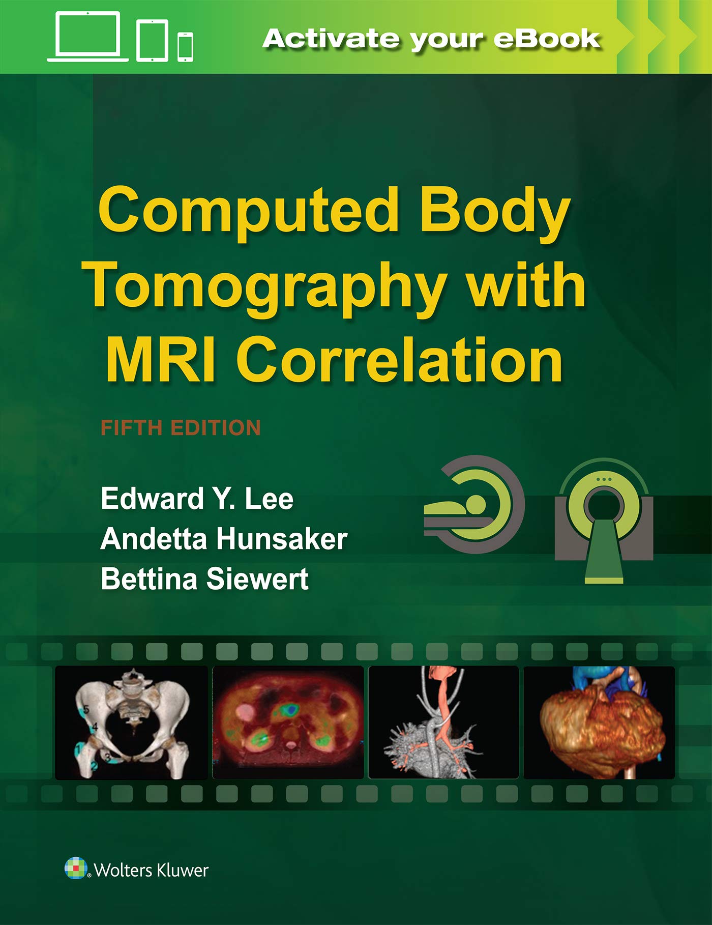 Computed Body Tomography with MRI Correlation: 9781496370495: Medicine ...