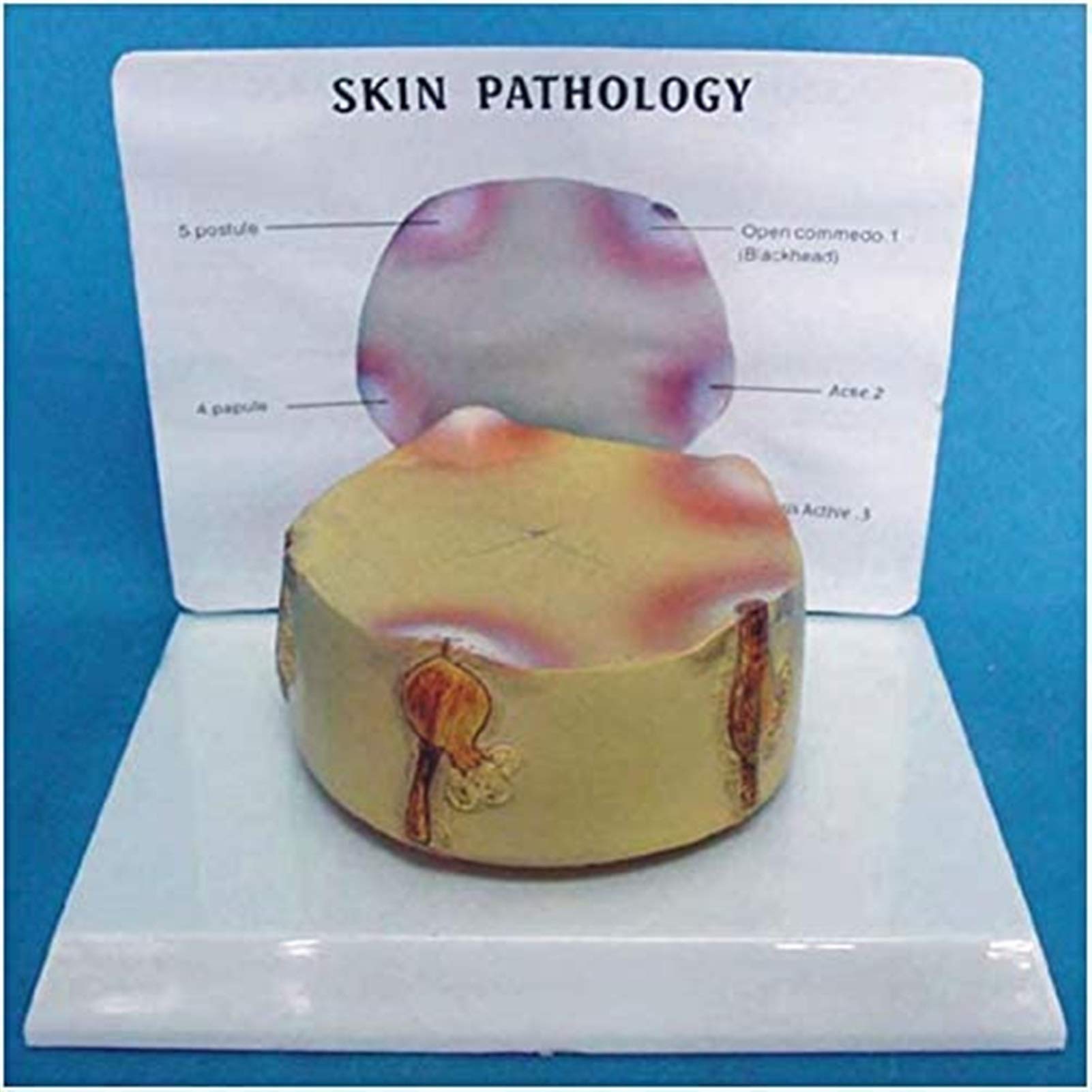 Buy Anatomy Model, Educational Model 3D Human Skin Model Human Skin ...