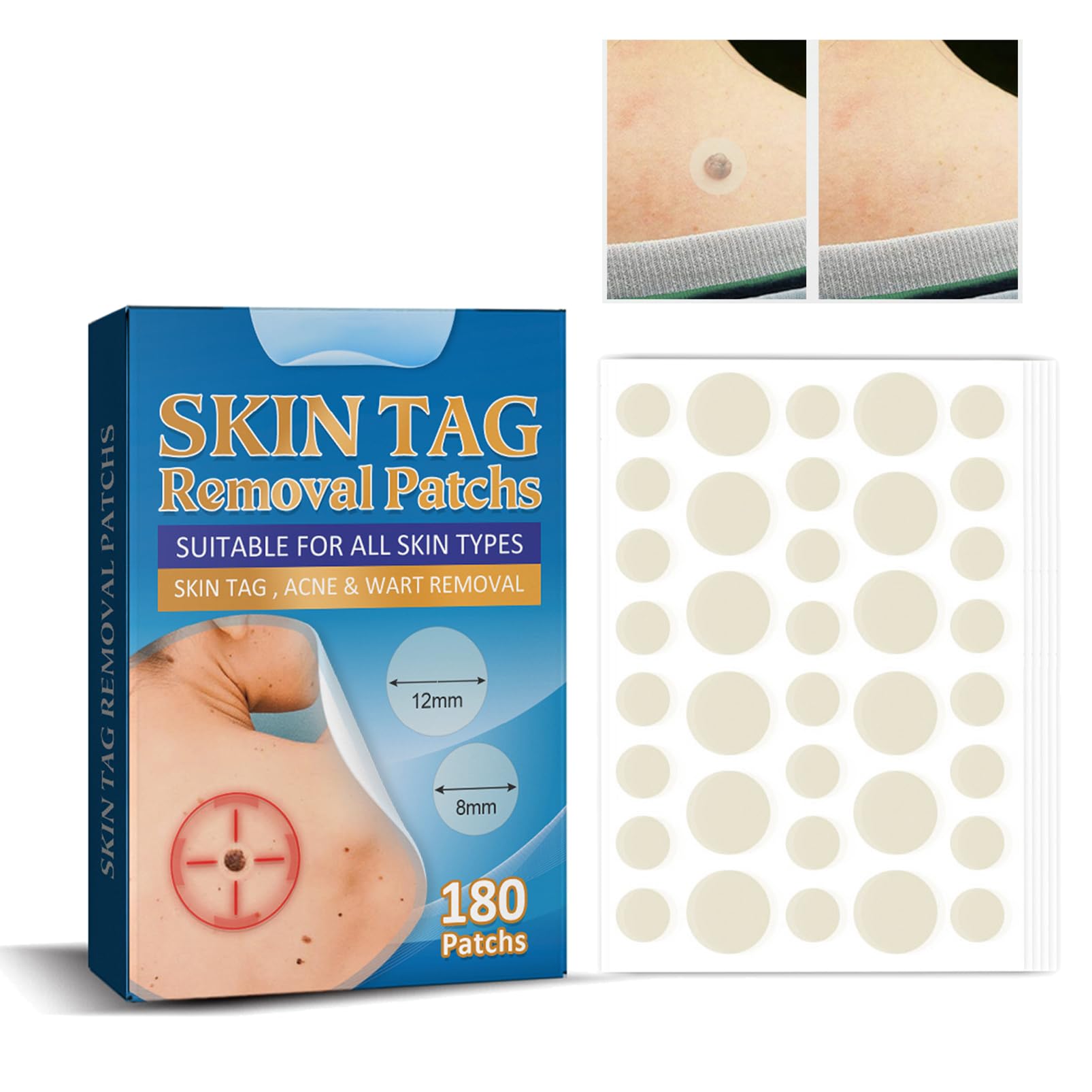 180pcs Skin-Tag-Removal丨Stickers Patches丨Tag Remover丨Skin Tag Patches ...