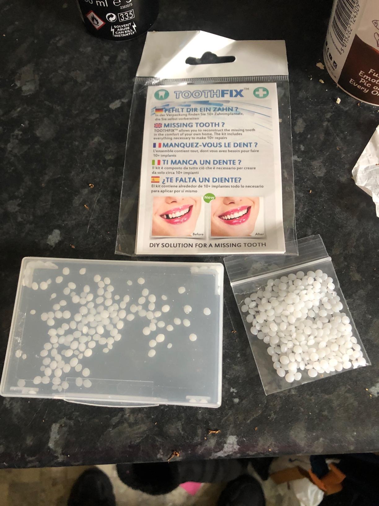 ToothFIX - DIY Missing Tooth Filler : Amazon.co.uk: Health & Personal Care