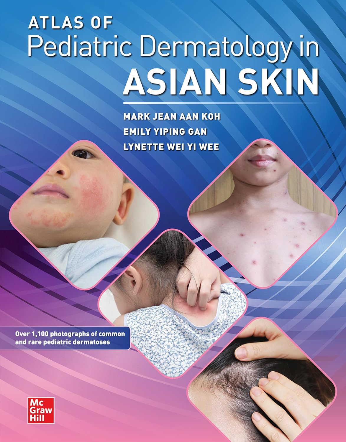 Atlas of Pediatric Dermatology in Asian Skin: 9781264267019: Medicine ...