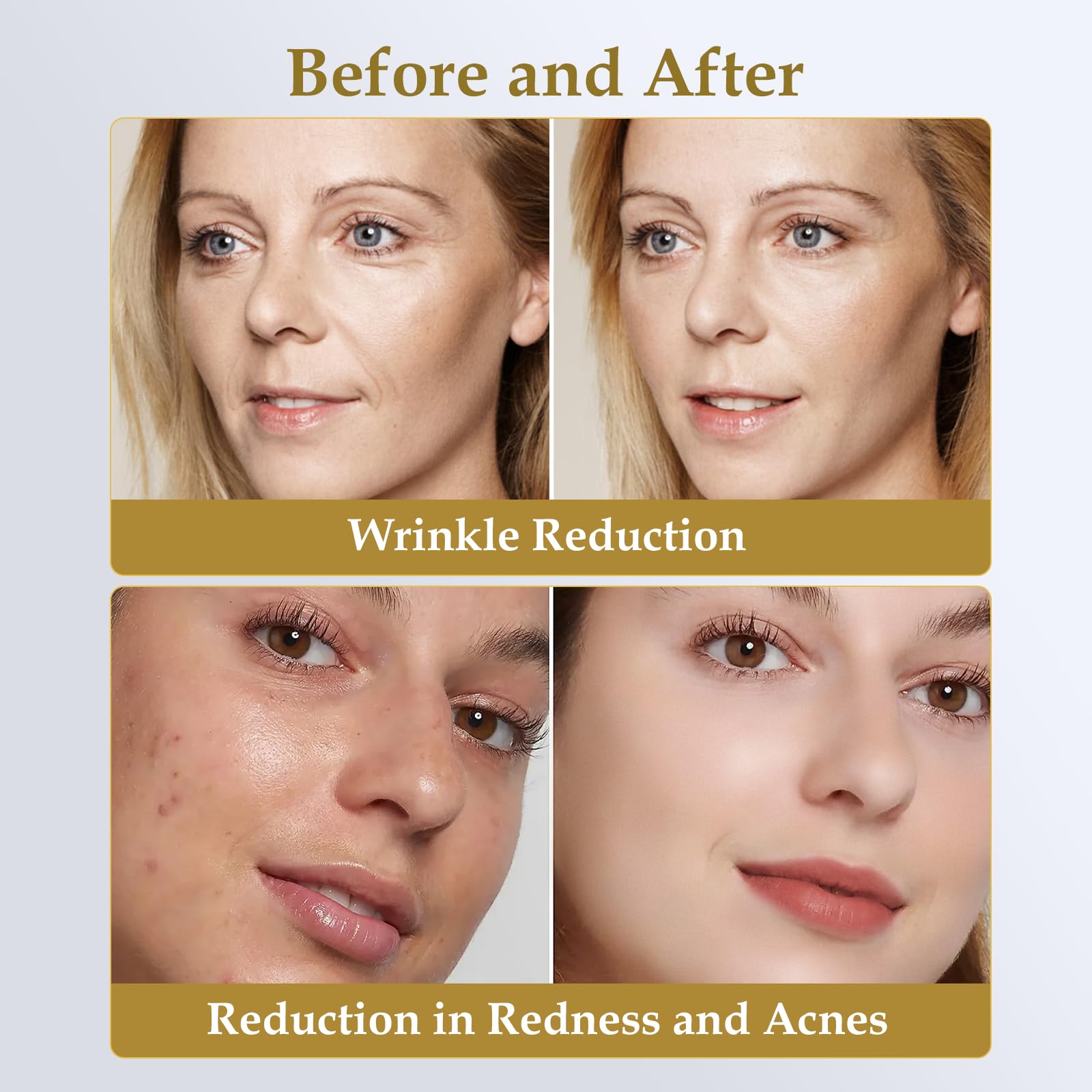 Red Light Face Mask, 8 Mo...B0D59TQ4TV | Encarguelo.com.ec
