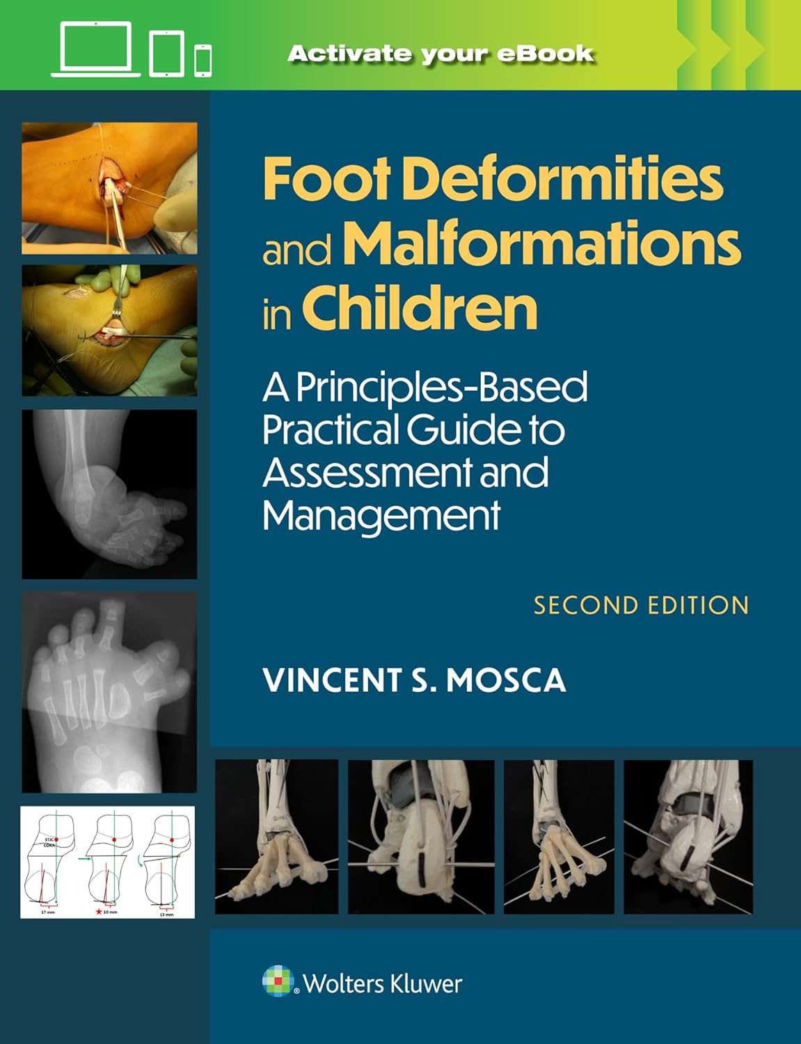 Foot Deformities and Malformations in Children: A Principles-Based ...