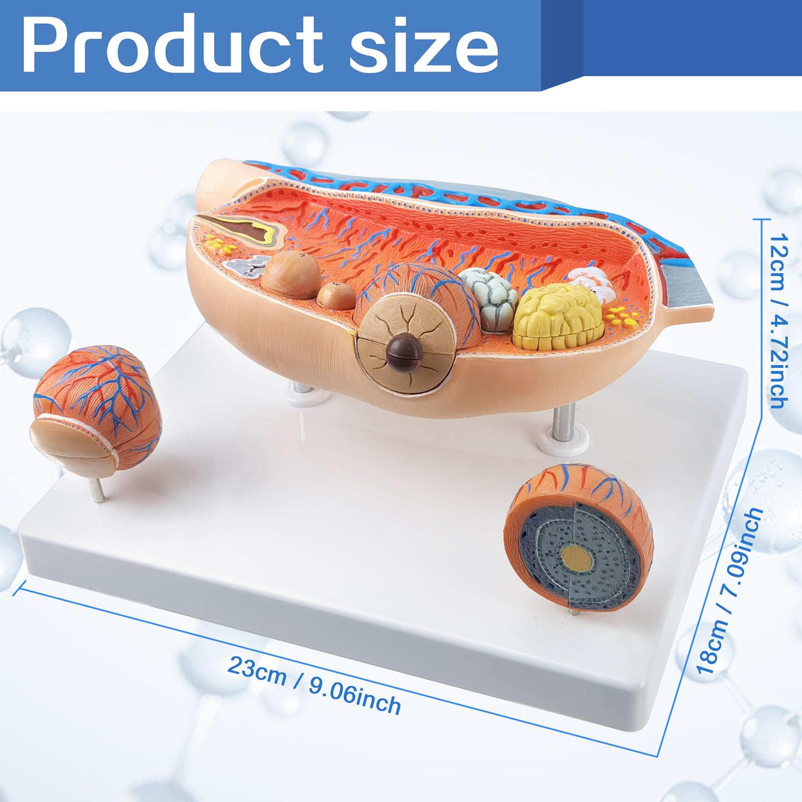 Ovary Model Uterus Ovary Model With Pathologies