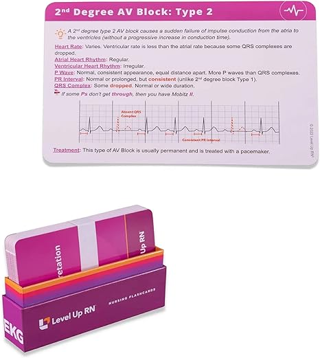 Amazon.com: Level Up RN – EKG Interpretation Flash Cards – for Nursing ...
