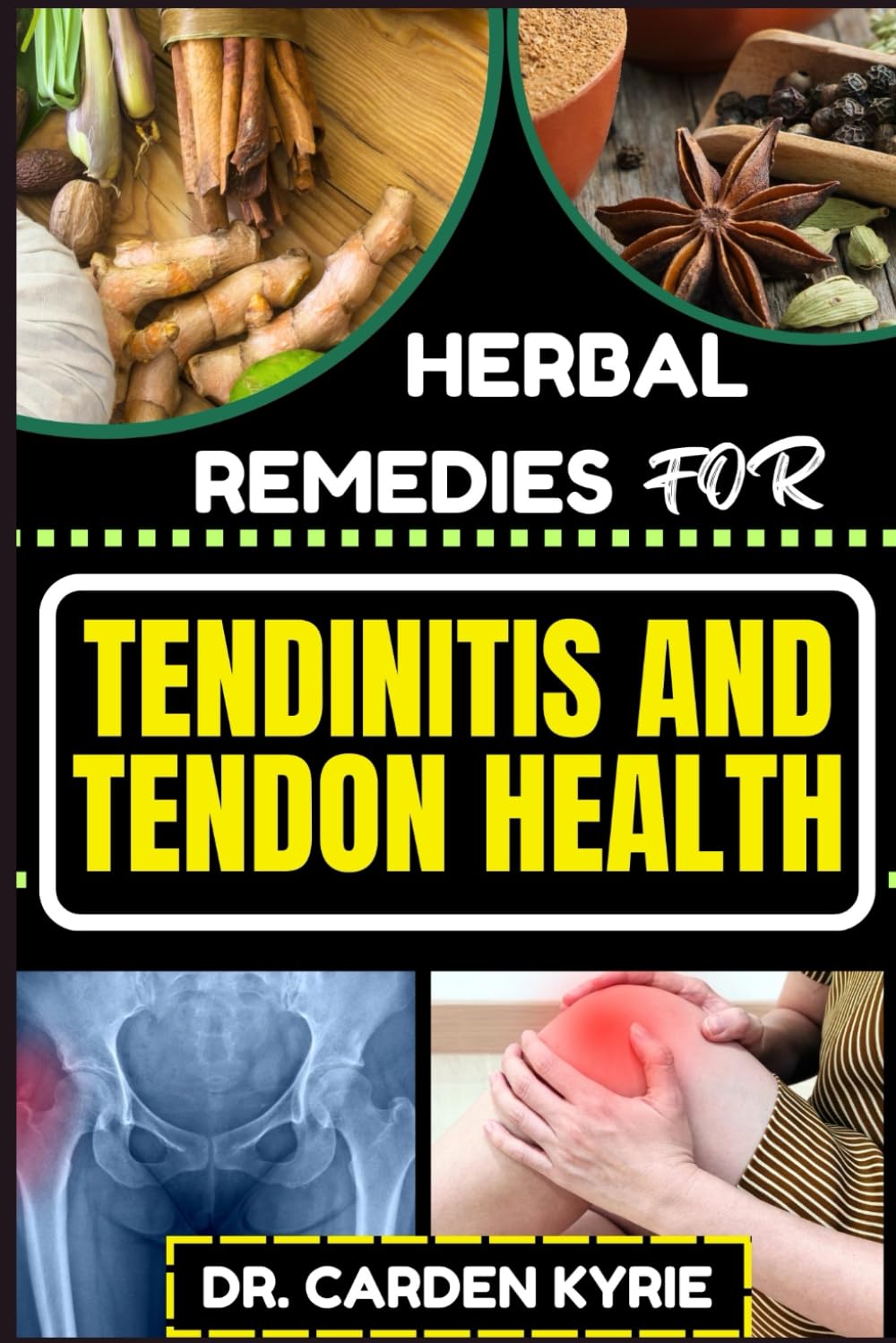 HERBAL REMEDIES FOR TENDINITIS AND TENDON HEALTH: Harnessing Herbal ...