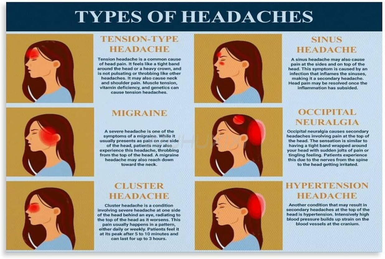 Amazon.com: Types of Headaches Posters, Migraine Medical Knowledge ...