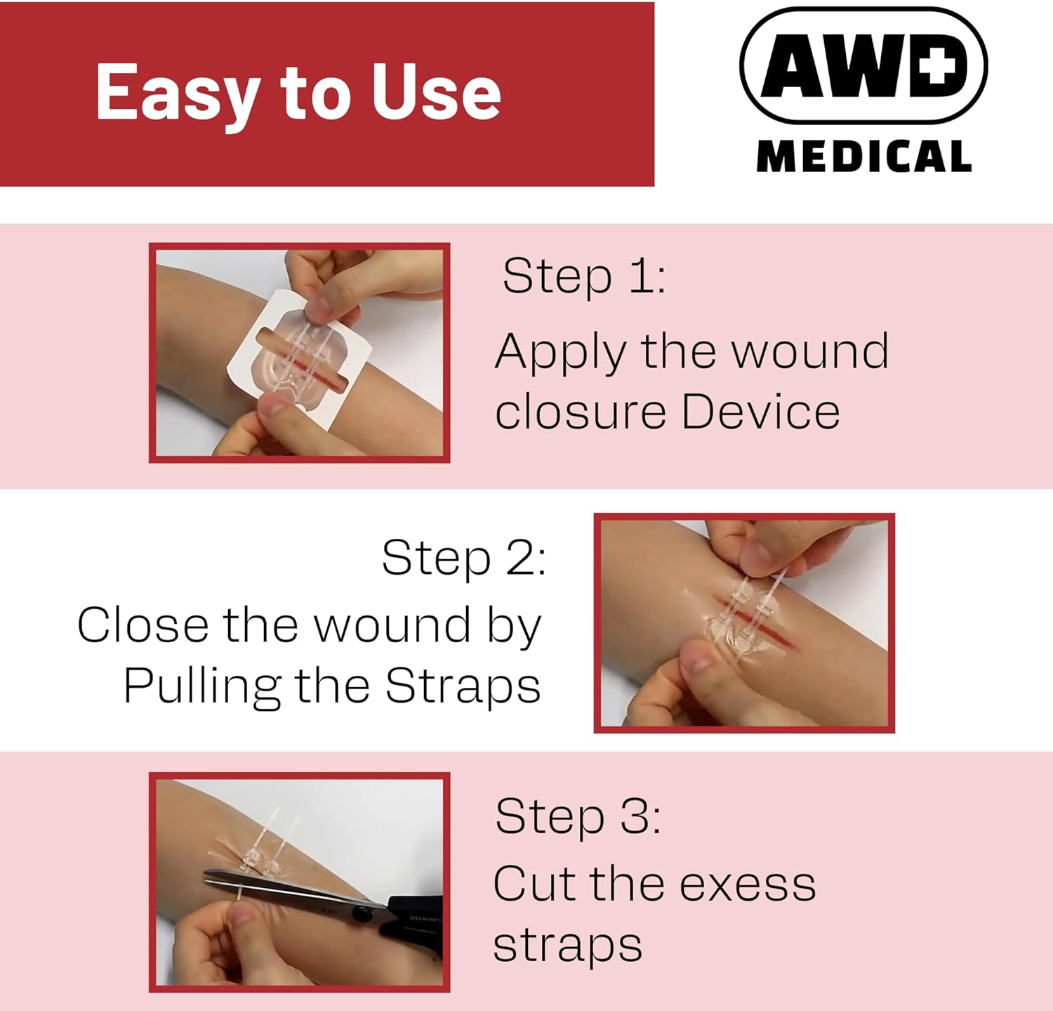 AWD Zip Stitch Wound Closure Strips - 2 Zipstitch Philippines | Ubuy