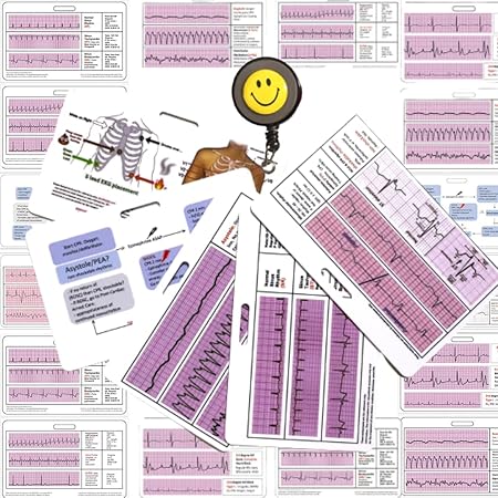 Amazon.com: EKG Nursing Badge Buddy CPR, ACLS, BLS, Code Blue Reference ...