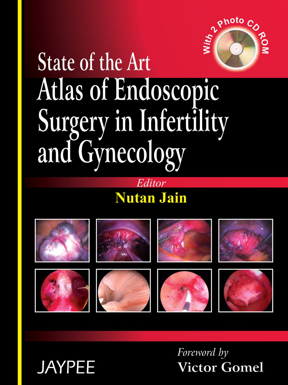 State of the Art Atlas of Endoscopic Surgery in Infertility and ...