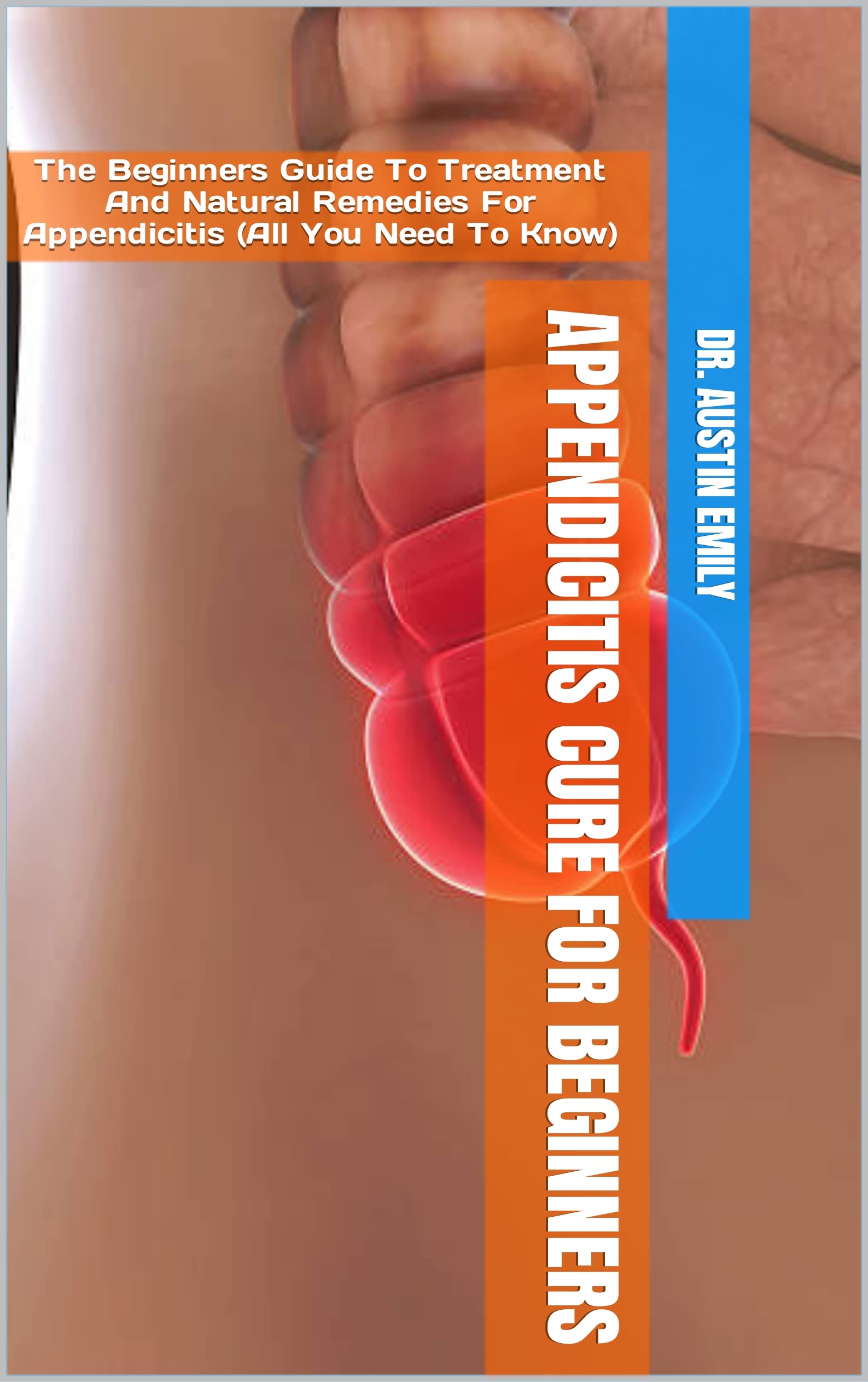 Buy Appendicitis Cure For Beginners : The Beginners Guide To And ...