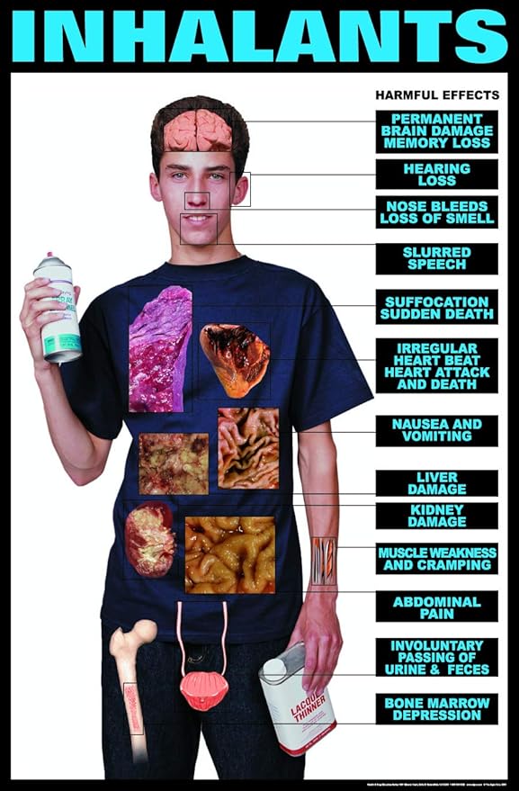 Amazon.com: Health and Drug Education Harmful Effects of Inhalants 24 ...
