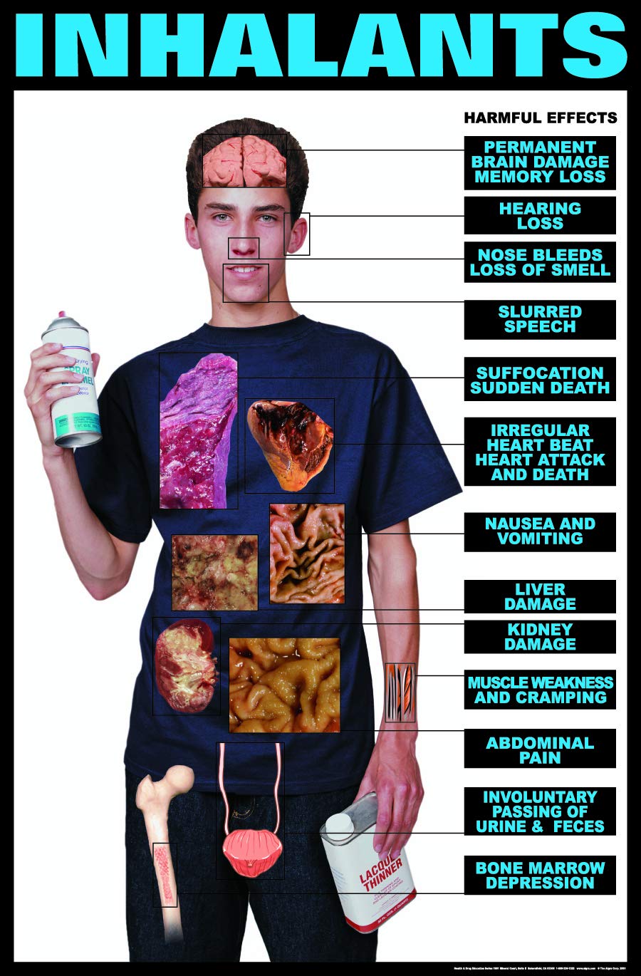 Amazon.com: Harmful Effects of Inhalants 24" X 36" Laminated Poster ...