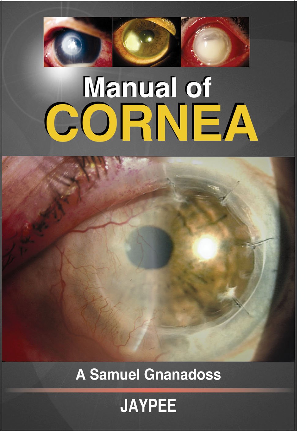 Manual of Cornea: 9788184481945: Medicine & Health Science Books ...