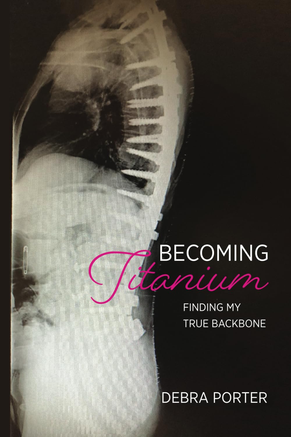 Becoming Titanium: Finding My True Backbone: Porter, Debra: 9798860312739: Amazon.com: Books