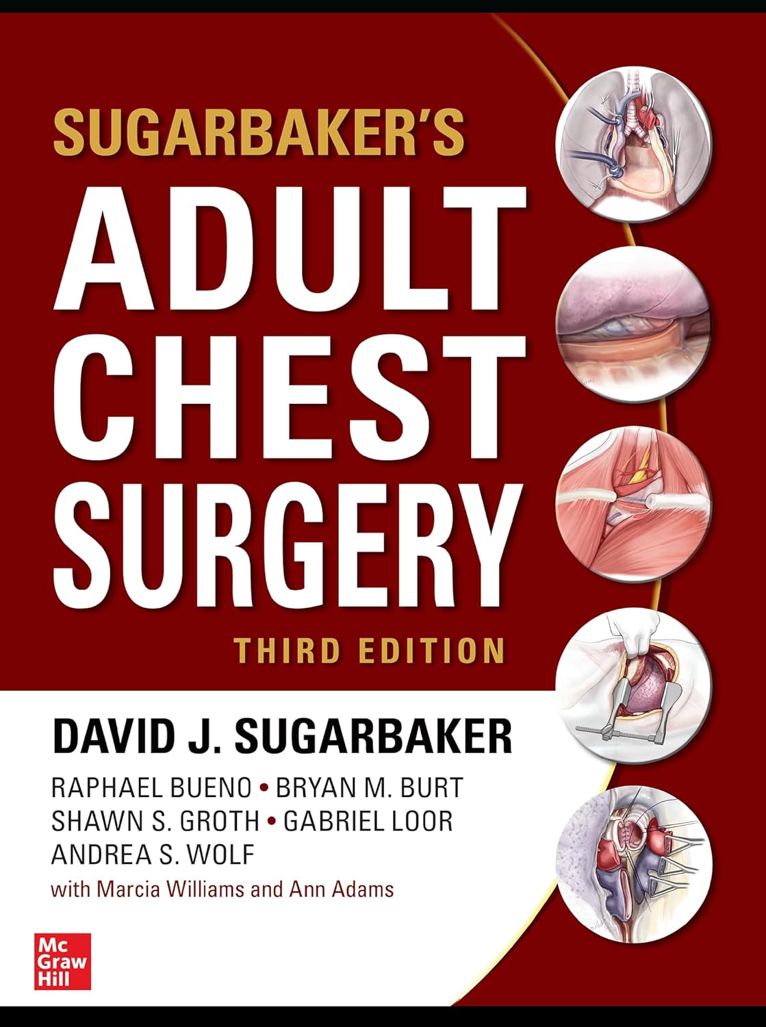Sugarbaker's Adult Chest Surgery, 3rd edition: 9781260026931: Medicine ...