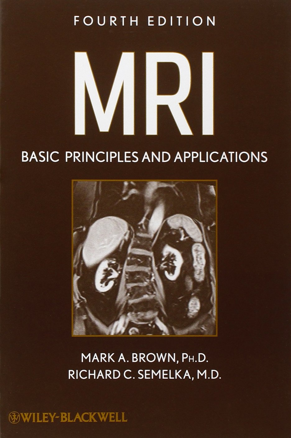 MRI: Basic Principles and Applications: 9780470500989: Medicine ...
