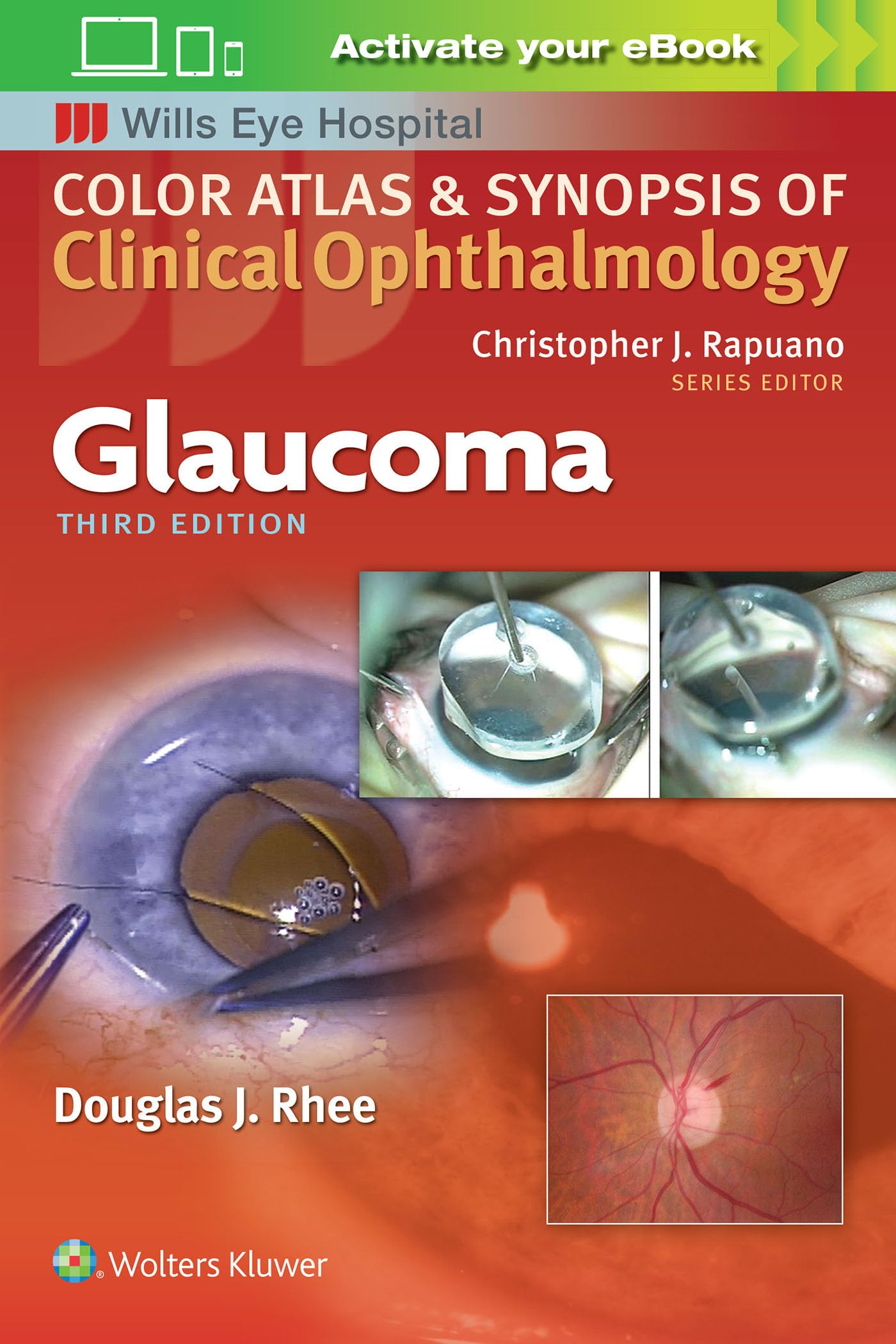 Glaucoma (Color Atlas and Synopsis of Clinical Ophthalmology ...