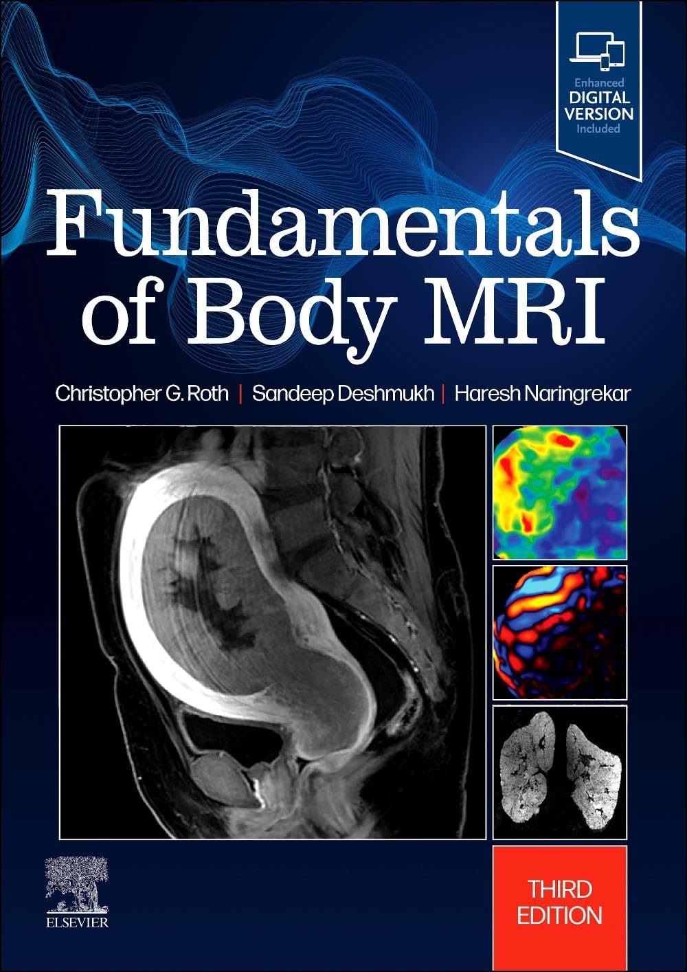 Fundamentals of Body MRI (Fundamentals of Radiology): 9780323833813 ...