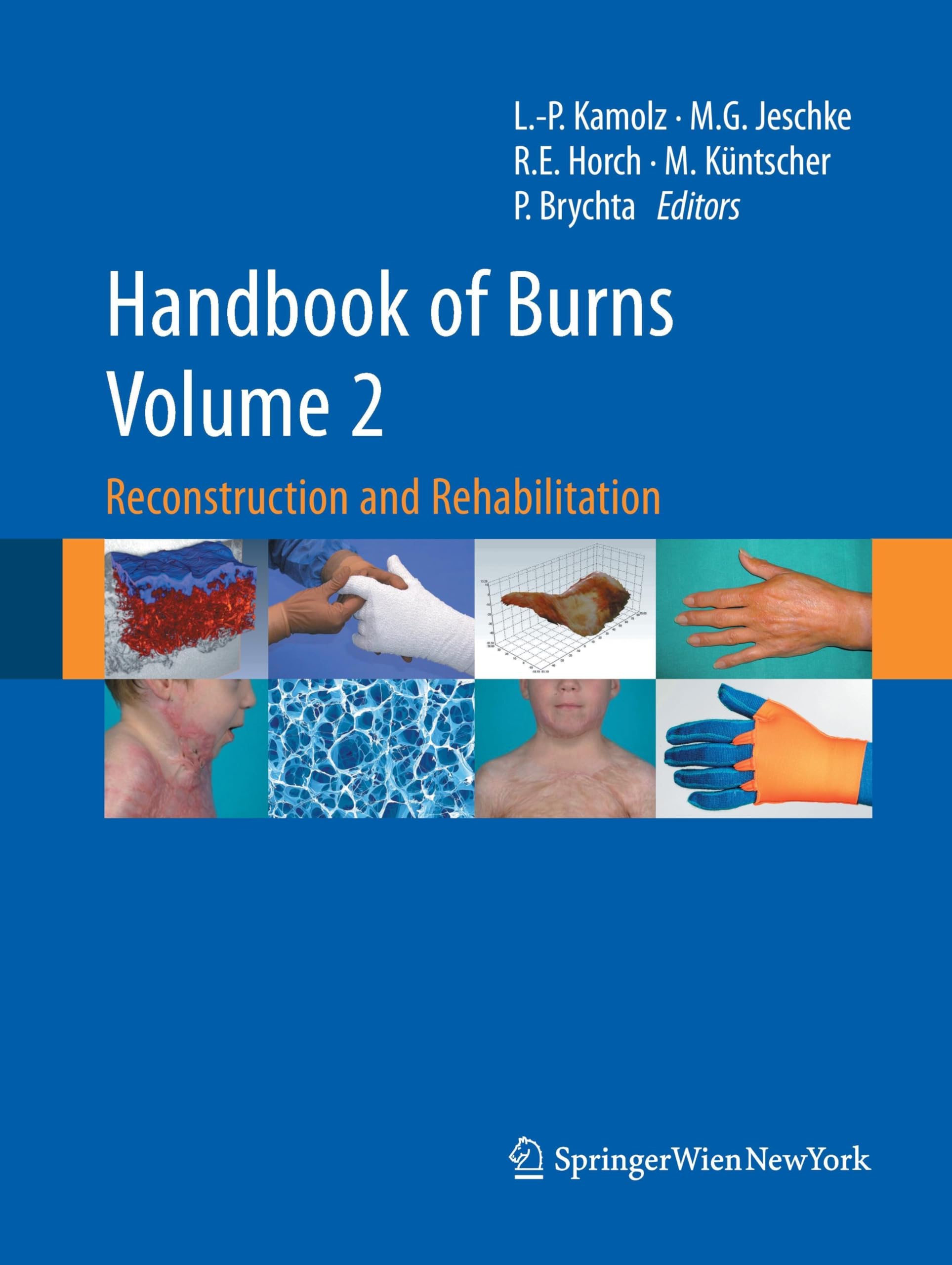 Handbook of Burns Volume 2: Reconstruction and Rehabilitation ...