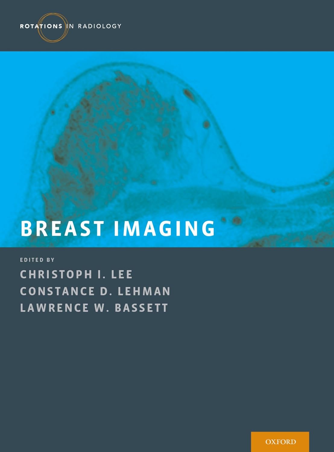 Amazon.com: Breast Imaging (Rotations in Radiology) eBook : Lee ...