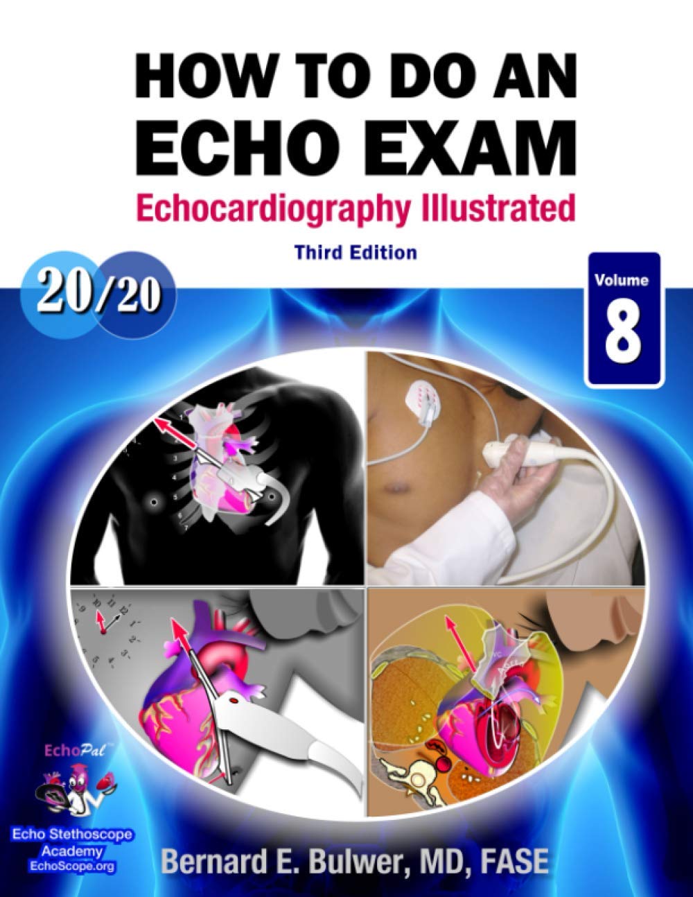 How to Do An Echo Exam: Third Edition (Echocardiography Illustrated ...