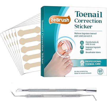 Amazon.com: CurveCorrect® Ingrown Toenail Home Treatment | Ingrown ...
