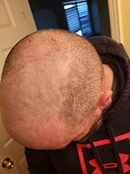 Remington Balder Pro rotary Head Shaver, 1 Count , Black : Amazon.ca ...