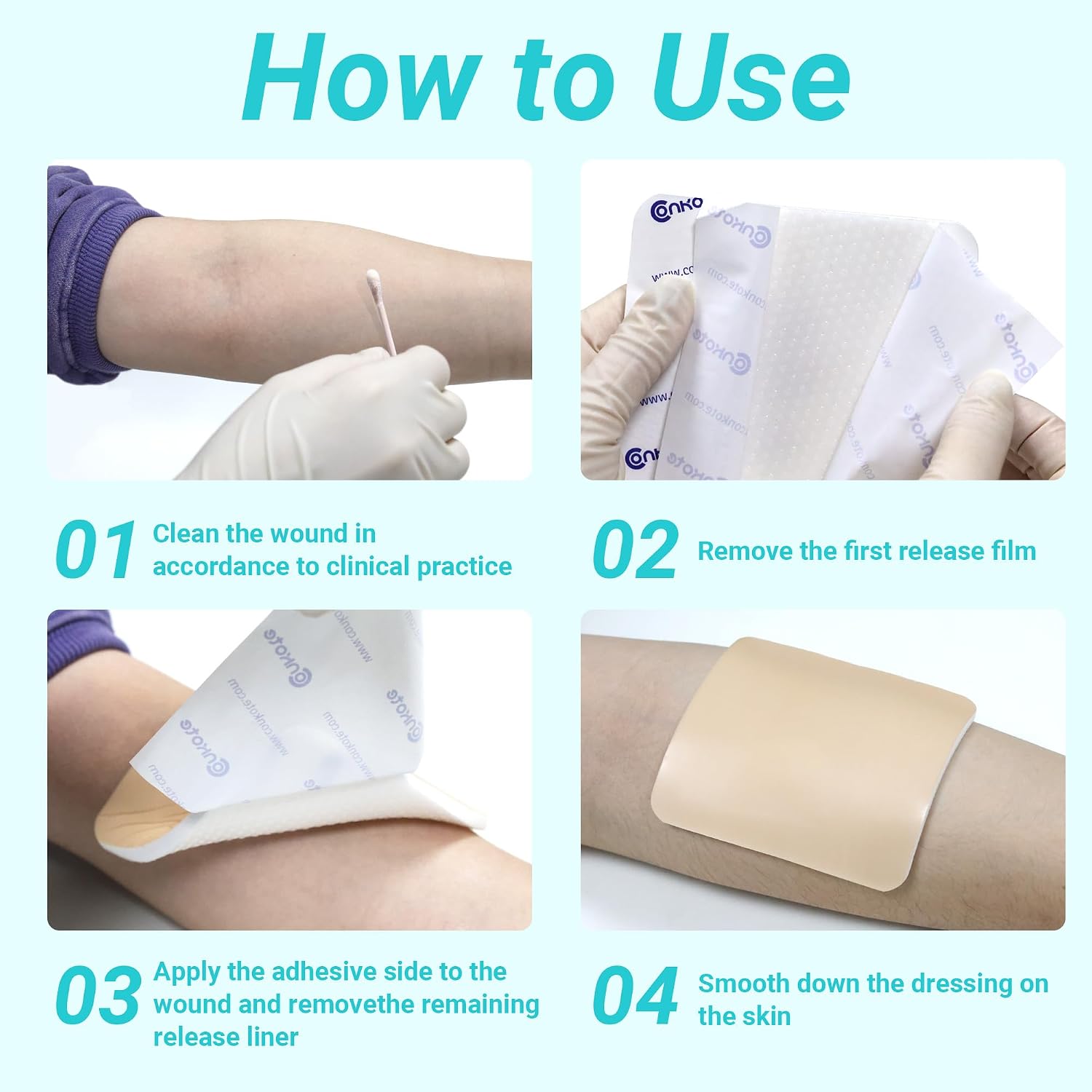 Conkote Silicone Foam Dressings Without Border Australia | Ubuy