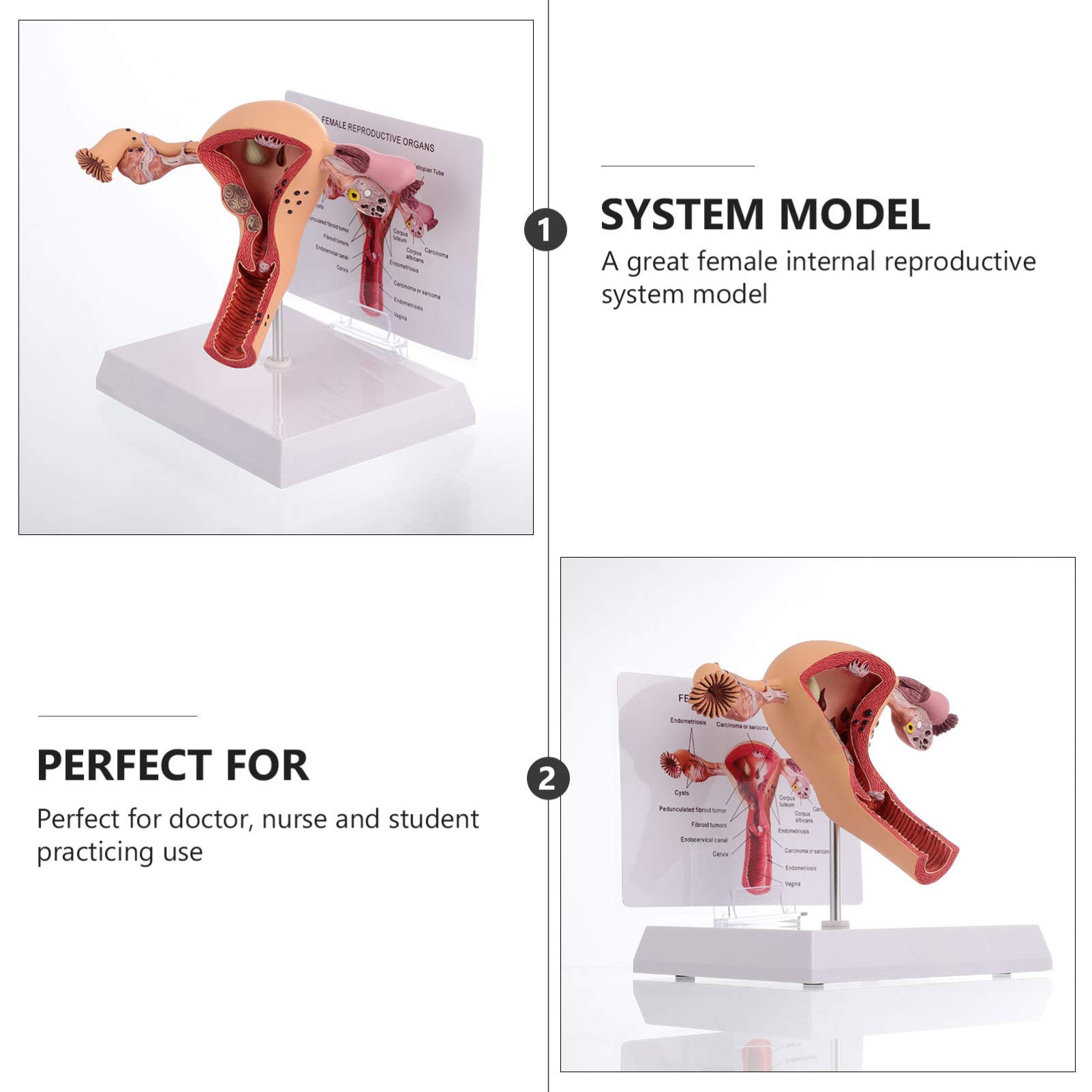 Buy Hemobllo Uterus Ovary Model Female Reproductive Organs System ...
