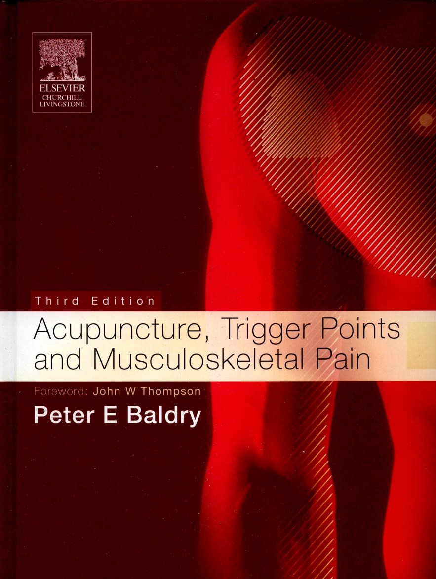 Acupuncture, Trigger Points and Musculoskeletal Pain: 9780443066443 ...