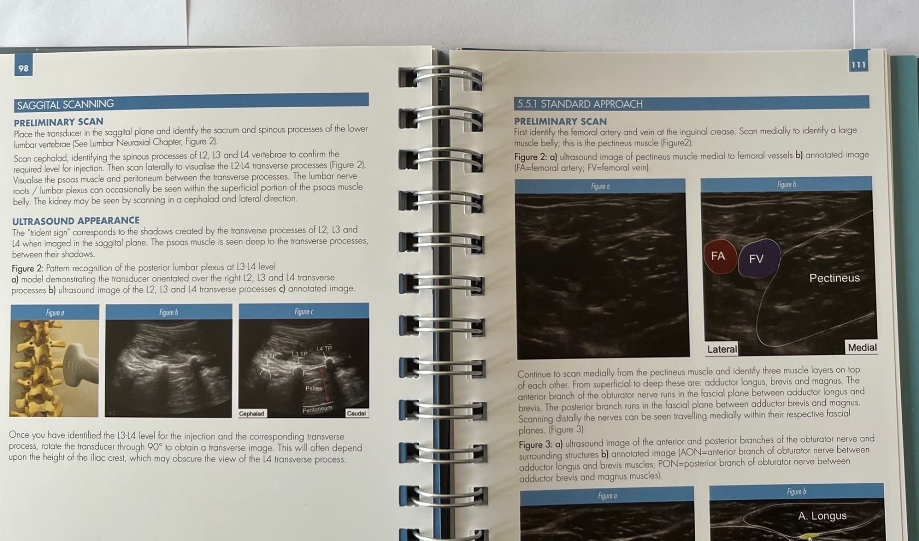 A Pocket Guide to Ultrasound Guided Regional Anaesthesia - Second ...
