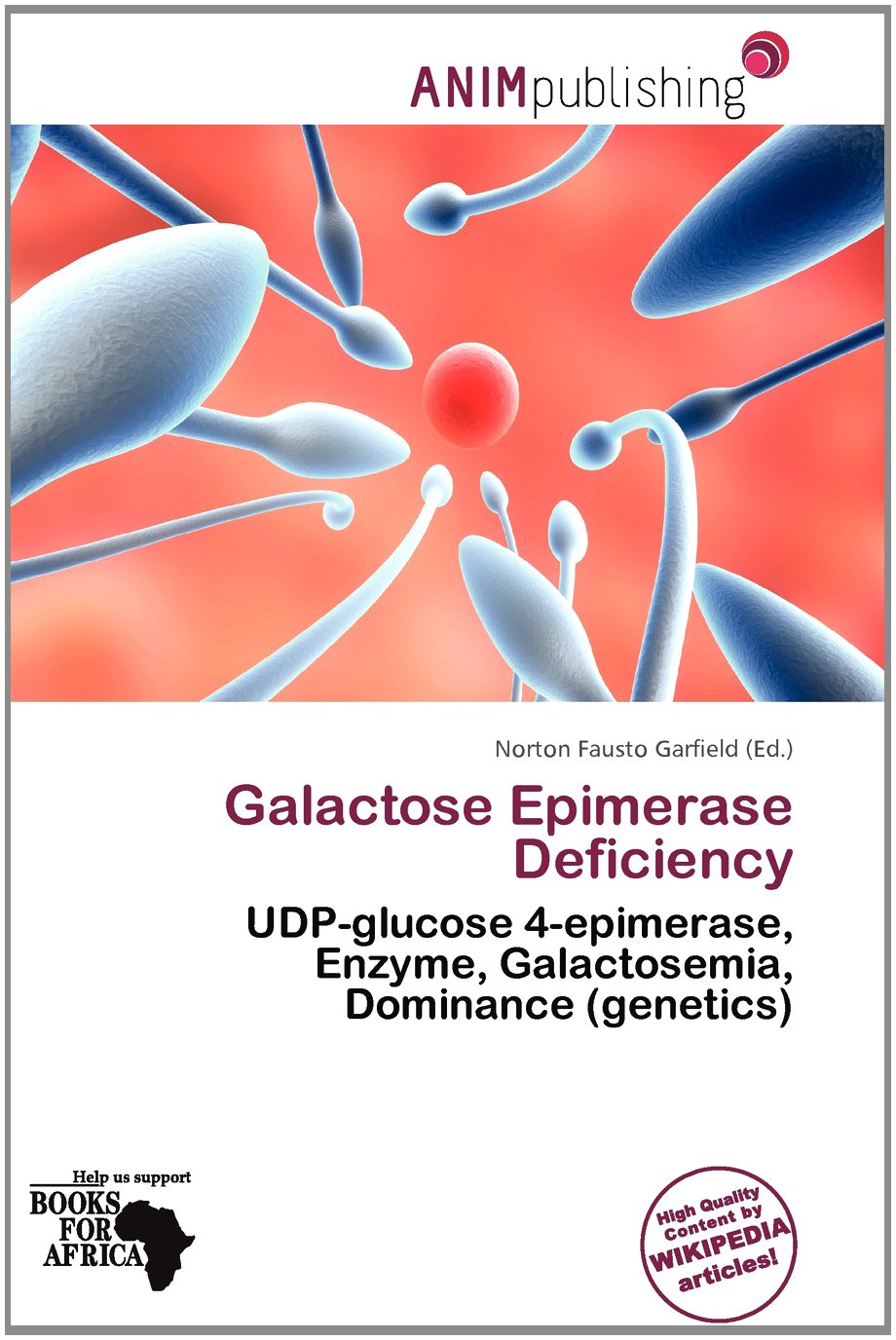 Amazon.co.jp: Galactose Epimerase Deficiency : 本