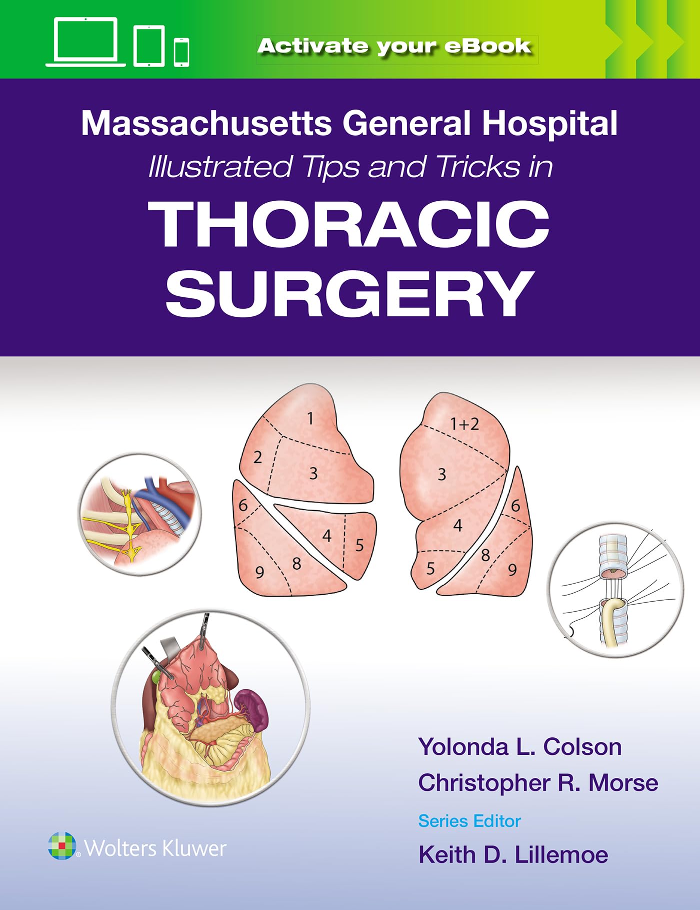 Massachusetts General Hospital Illustrated Tips and Tricks in Thoracic ...