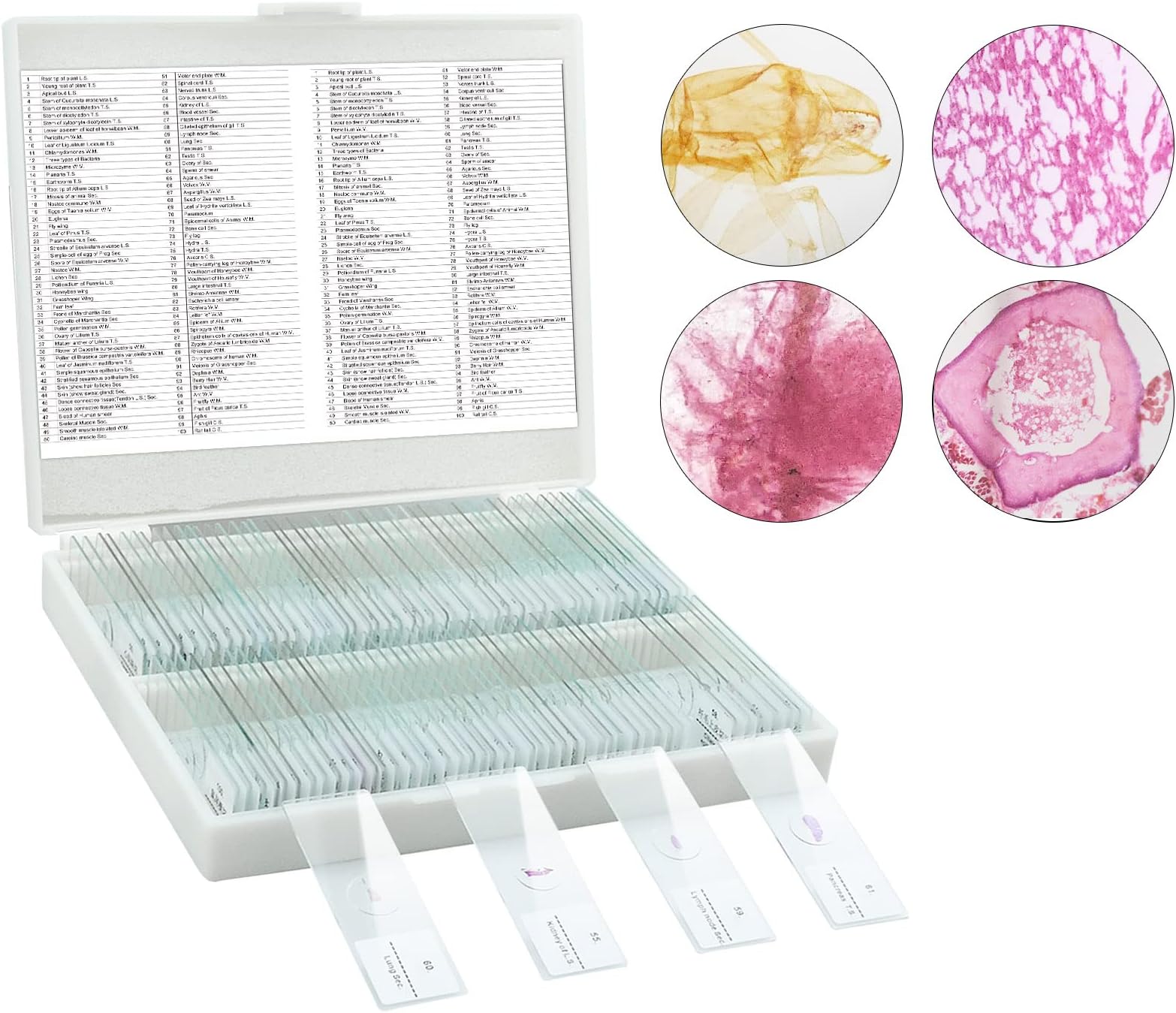 Amoeba Proteus Prepared Microscope Slide, Whole Mount: Microscope ...