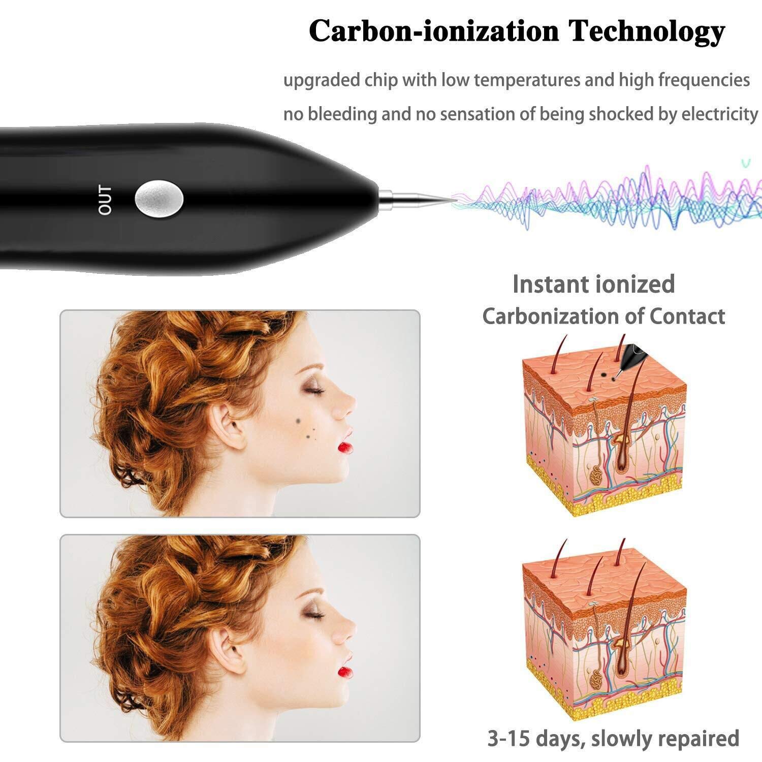 Skin Tags Remover Pen, VOONEEN Mole Remover with 9 Strength Levels &LED ...