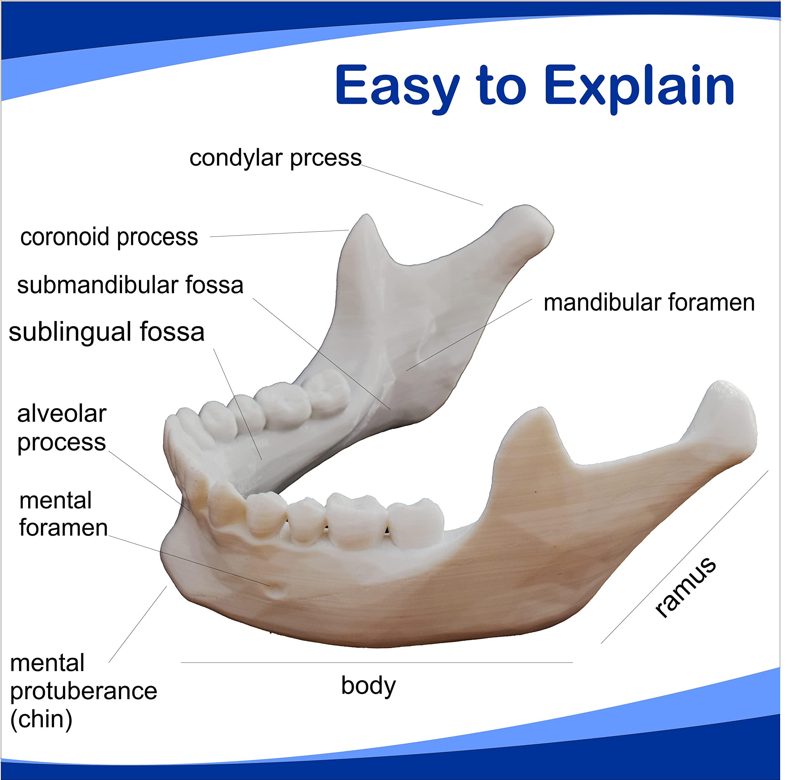 Mandible Bone Labeled Temporomandibular Joint Wikipedia