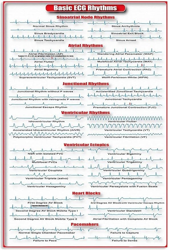 Amazon.com: Basic Ecg Rhythms Infographic Metal Sign Wall Decor ...