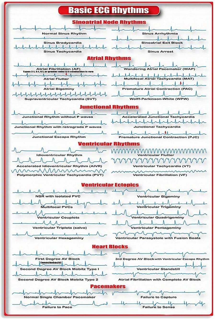 Amazon.com: Basic Ecg Rhythms Infographic Metal Sign Wall Decor ...