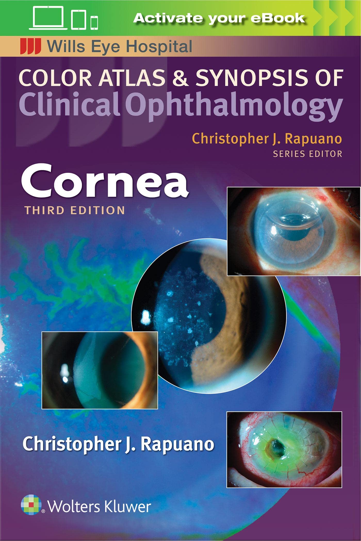 Amazon | Cornea (Color Atlas and Synopsis of Clinical Ophthalmology ...